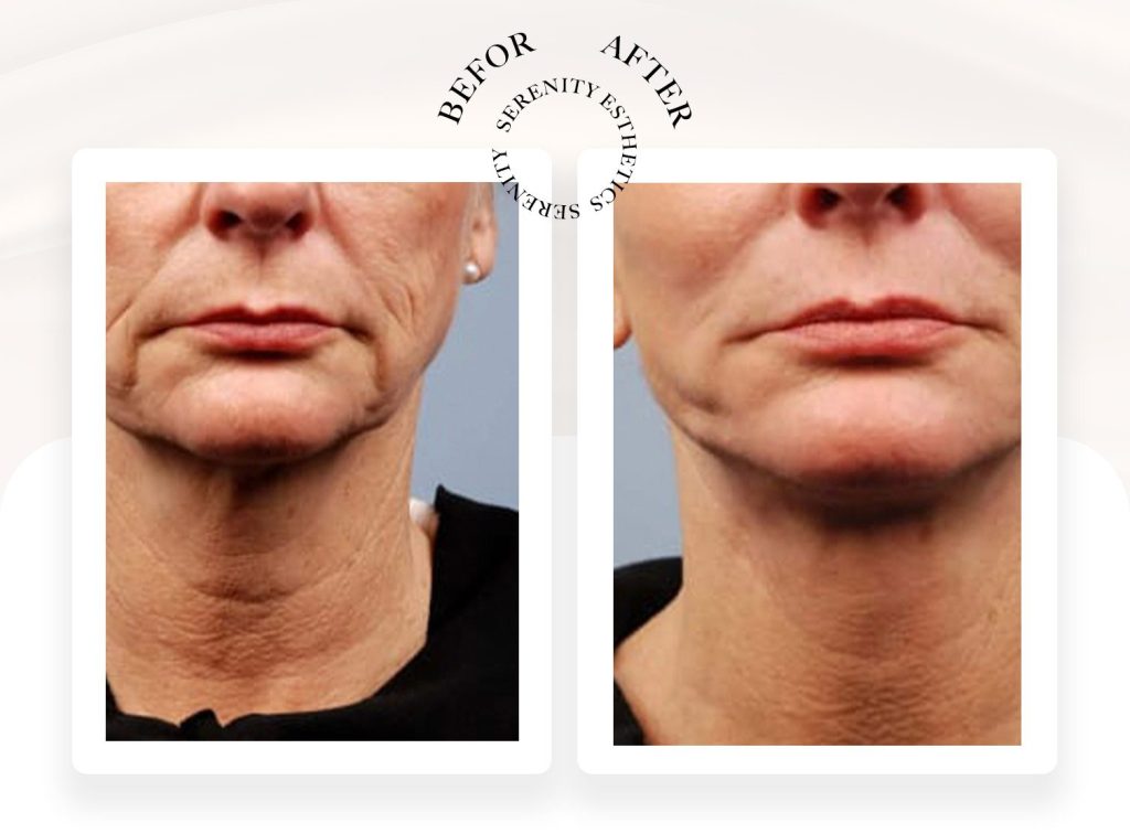 Serenity Spa & Spa - Facial Spa & Esthetician- Des Moines, Iowa