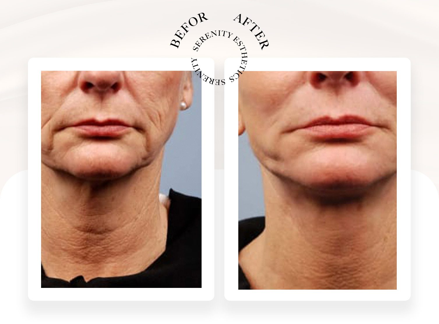 Advanced Skin Analysis - Serenity SPA USA