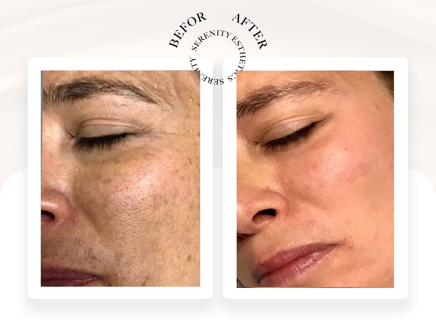 Facial in Lincoln, Nebraska - Serenity Spa & Facials Near Me